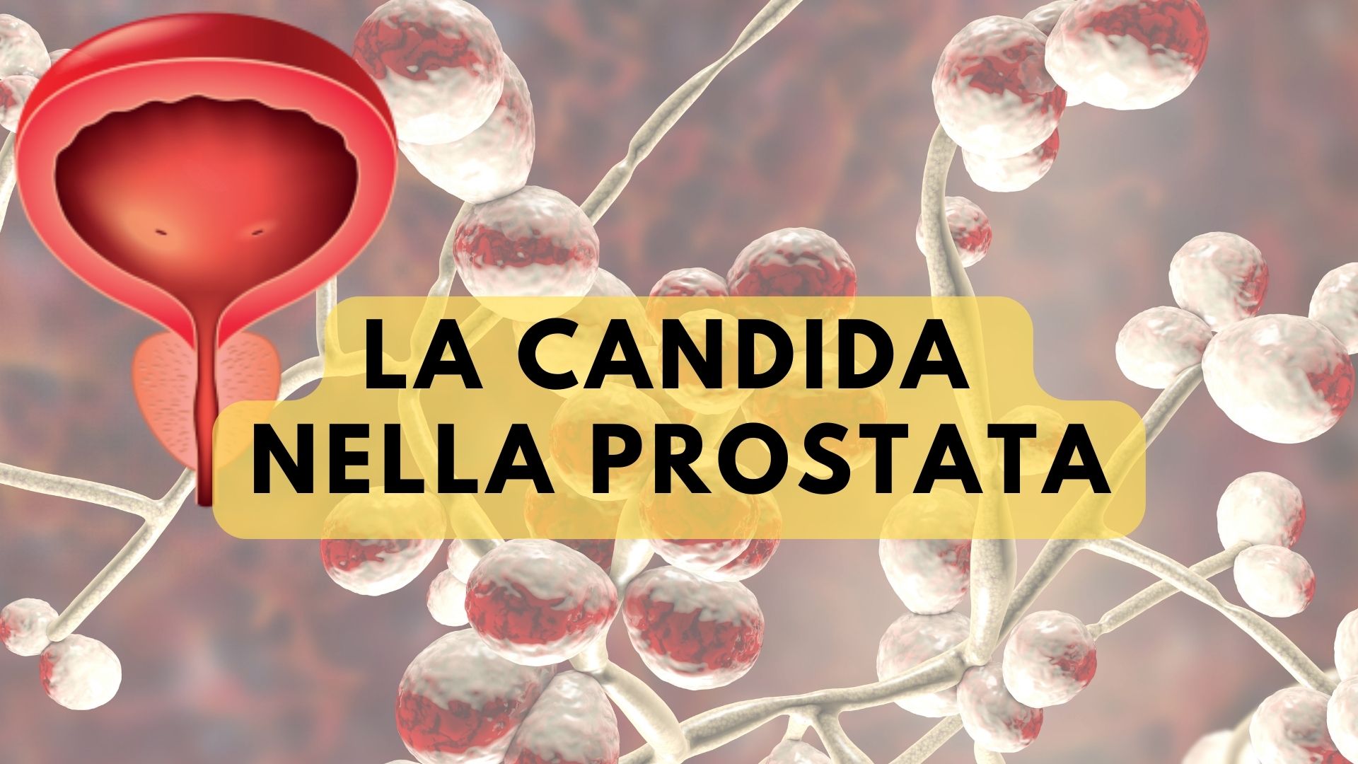 La Prostata e la Candida: Capire il Vero Problema
